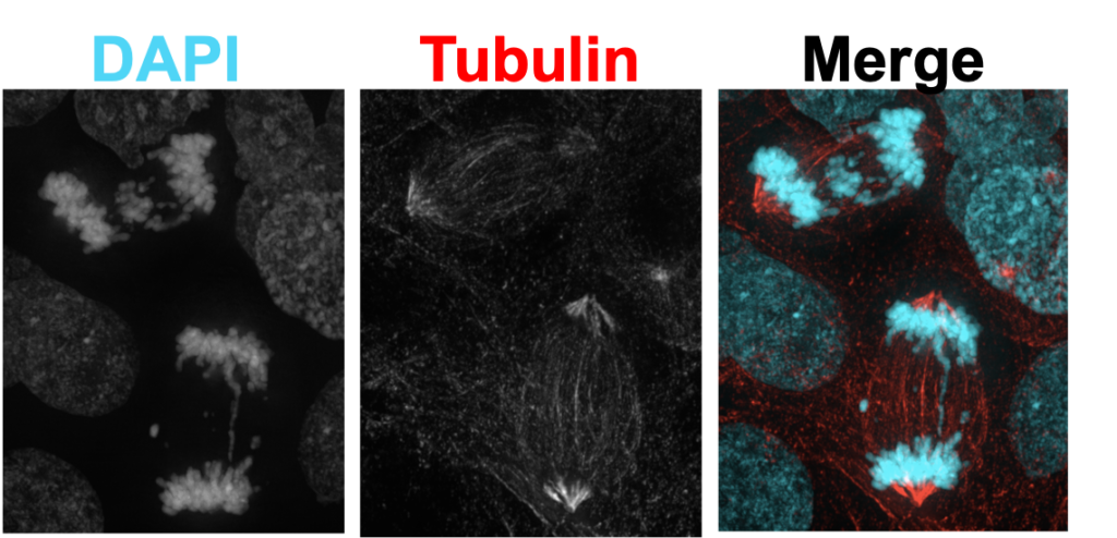 Pippa Cosper, MD, PhD – Department of Human Oncology – UW–Madison