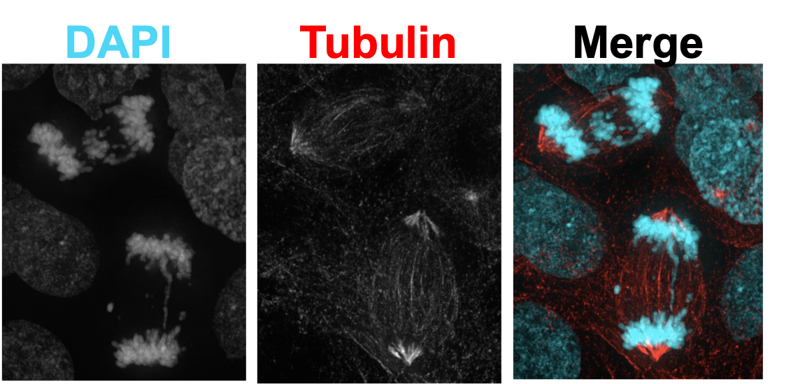 Pippa Cosper, MD, PhD – Department of Human Oncology – UW–Madison