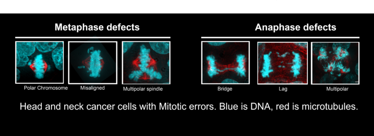 Pippa Cosper, MD, PhD – Department of Human Oncology – UW–Madison